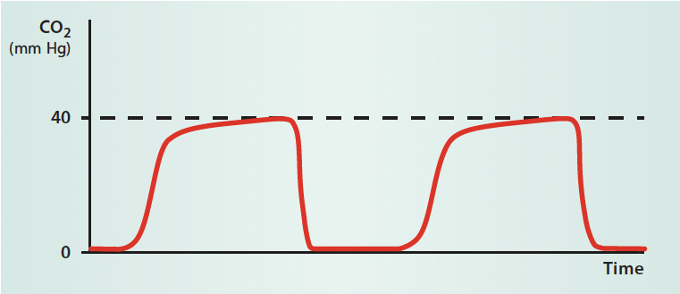 Top 10 Essentials: Care of Patients on Ventilators.- American Nurse