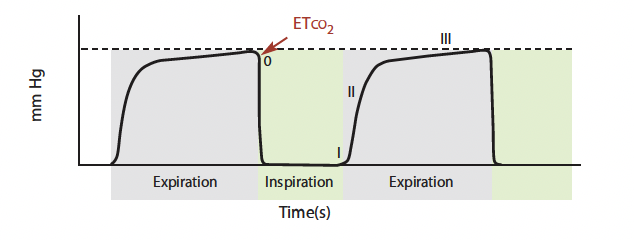 Understanding end-tidal CO2 monitoring