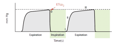 Understanding end-tidal CO2 monitoring