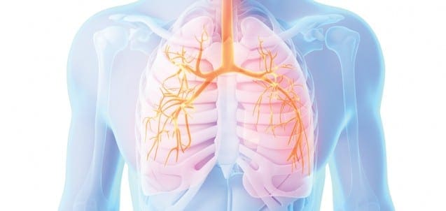 Caring for patients in respiratory failure