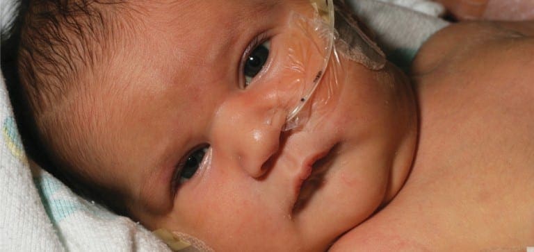 Verifying NG feeding tube placement in pediatric patients