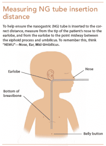 Verifying NG feeding tube placement in pediatric patients