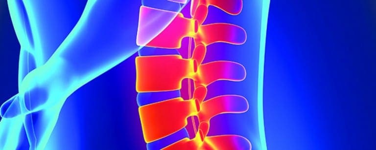 Caring for patients with lumbar drains