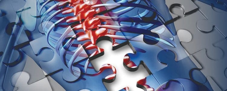 Caring for patients with spinal cord injuries
