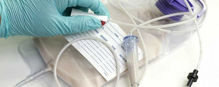 Enteral feeding: Indications, complications, and nursing care