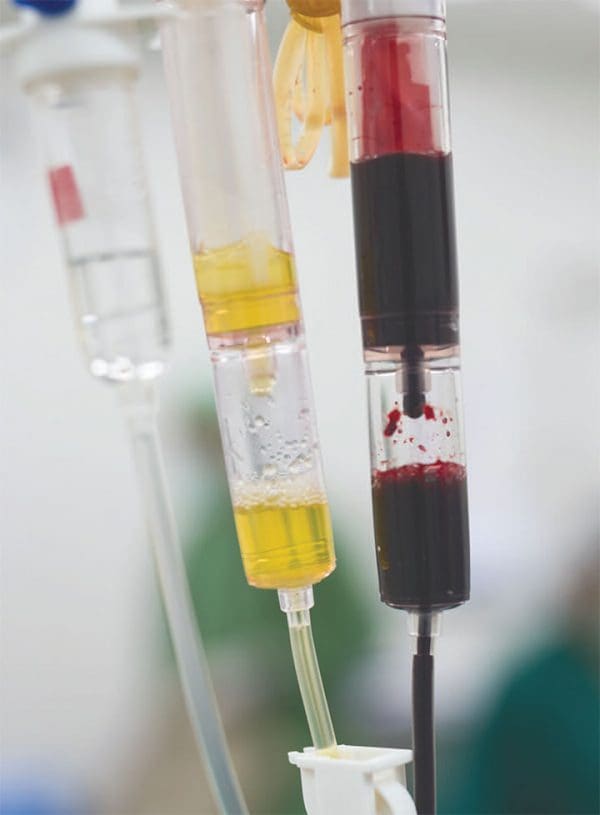 Stopping acute upper-GI bleeds - American Nurse Today