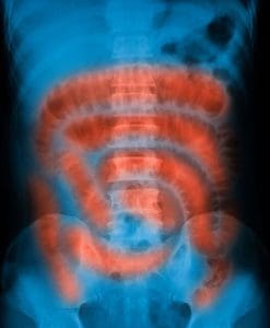 New endoscopic device for controlling GI bleeding