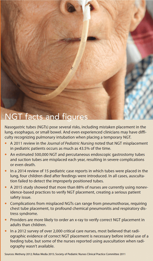 Reducing nasogastric tube misplacement through evidence-based practice