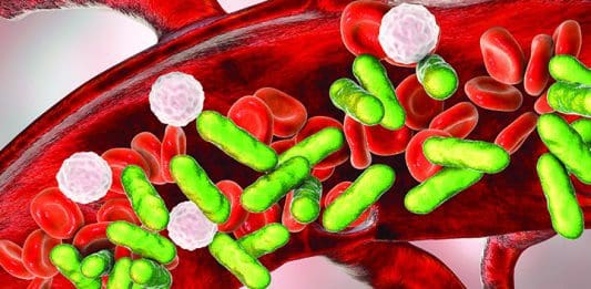 Sepsis bundle Archives - American Nurse