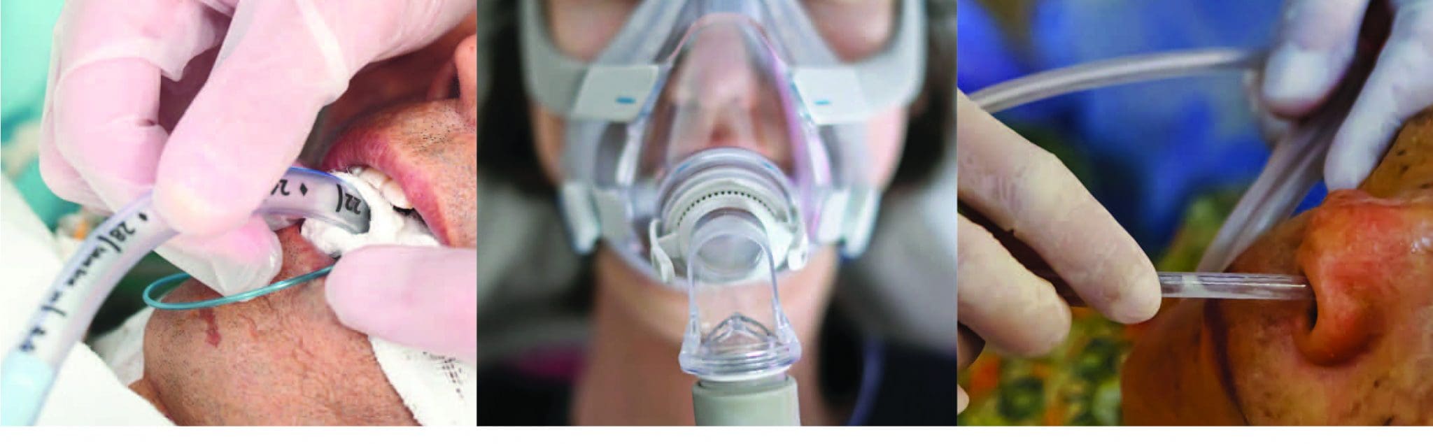 C.A.R.E. to prevent medical device-related pressure injuries