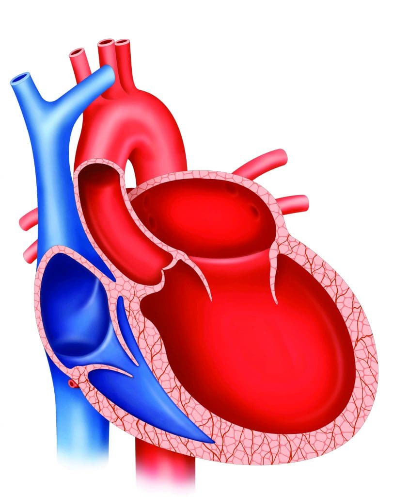 ACM Arrhythmogenic Cardiomyopathy An Educational Overview ACM Arrhythmogenic Cardiomyopathy An Educational Overview