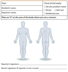 PI or pressure injury prevention in long-term care treatment