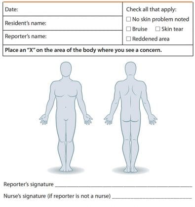 PI or pressure injury prevention in long-term care treatment