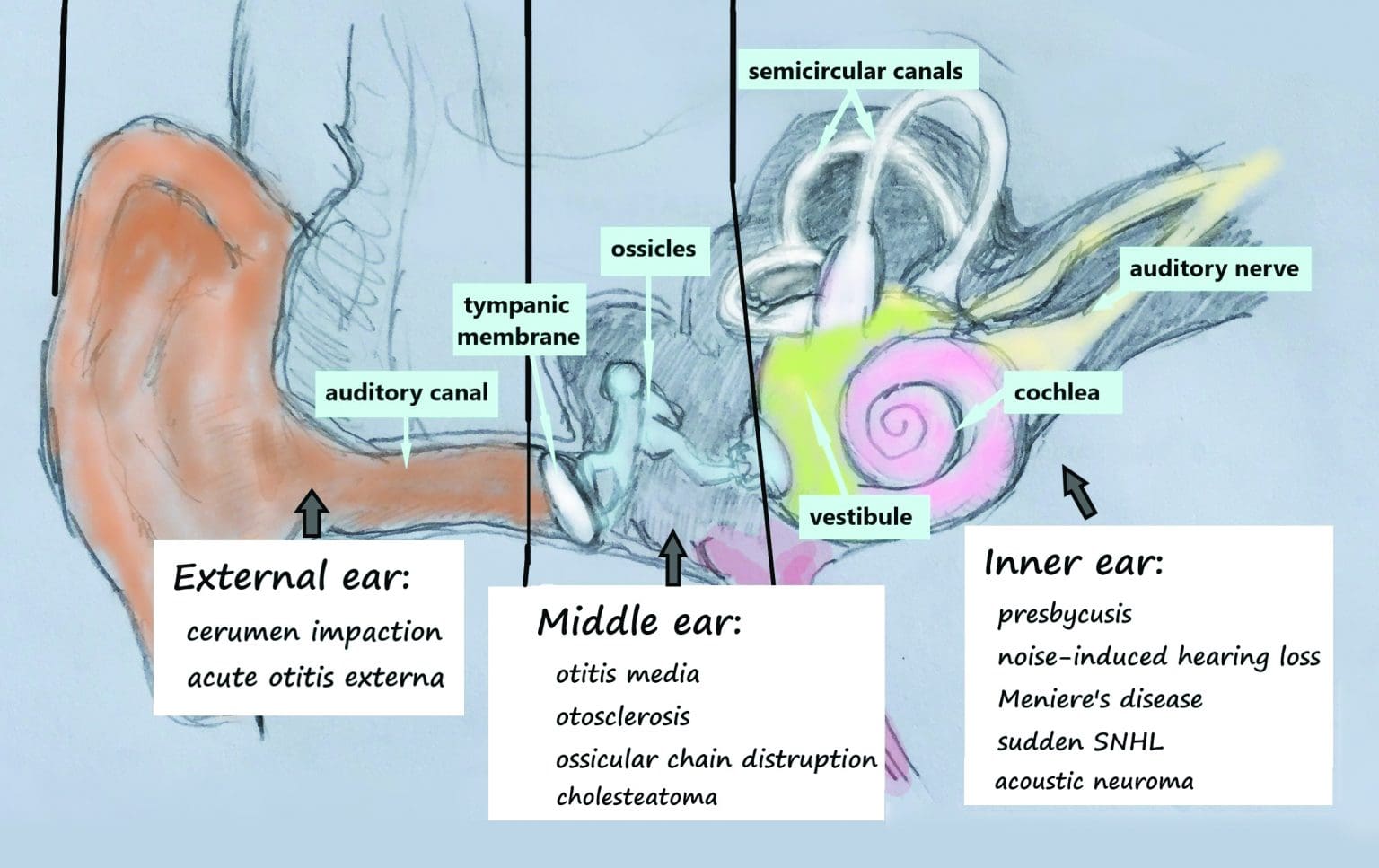 Hearing loss: common causes in adults and how nurses can help