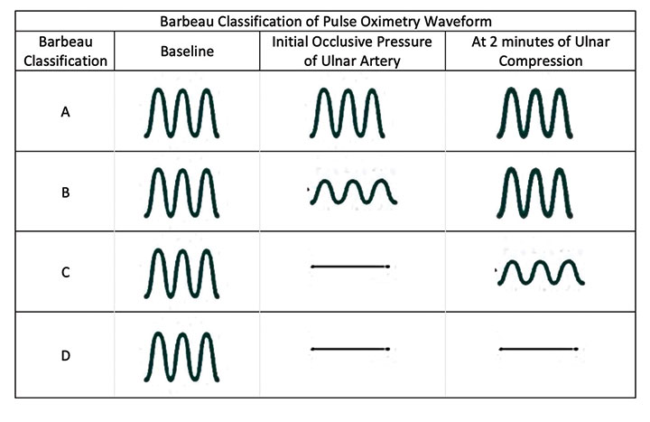 Radial artery occlusion: preventing this troubling complication