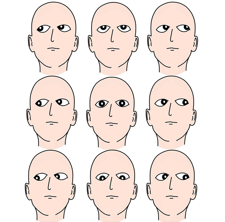 Cranial nerve assessment: a practical approach