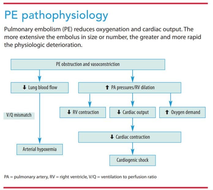 Pulmonary embolism: Surveillance is key