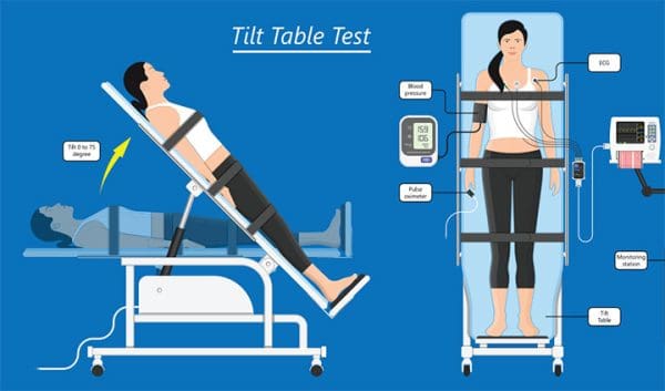 POTS: Postural Orthostatic Tachycardia Syndrome