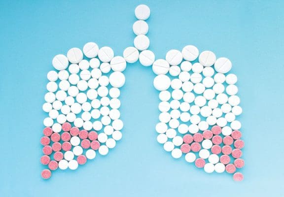 TB test results and how to interpret