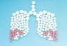 TB test results and how to interpret