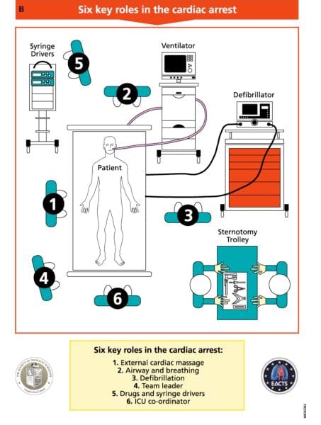 Resuscitation after cardiac surgery: Best practice recommendations