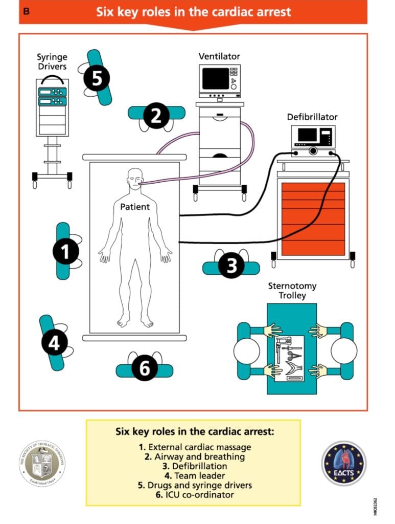 Resuscitation after cardiac surgery: Best practice recommendations