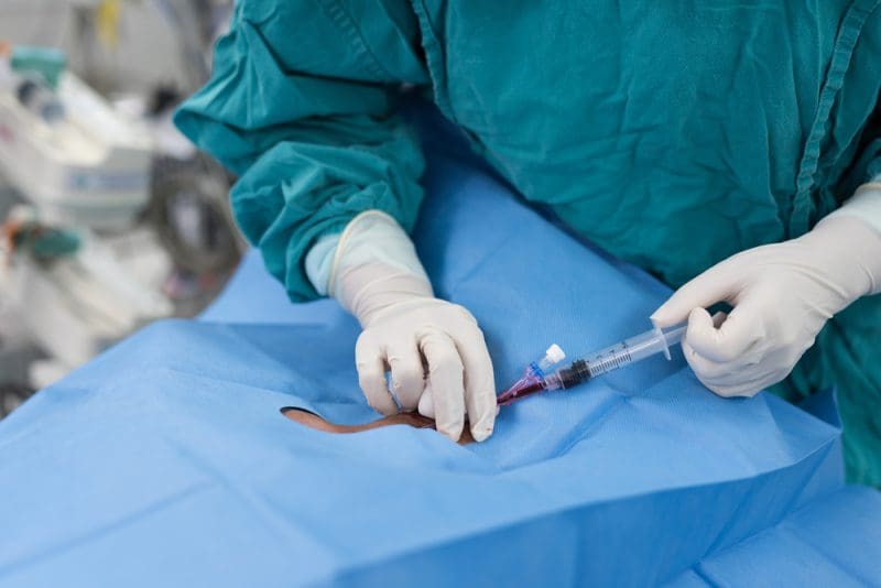 Dedicated Nursing Team Cuts Central-Line Infections Nearly in Half ...