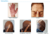 Self-acupressure to reduce stress and fatigue