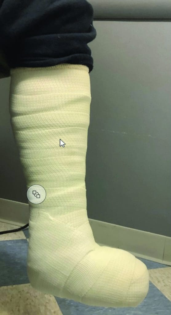 Diabetic foot ulcers in ambulatory settings