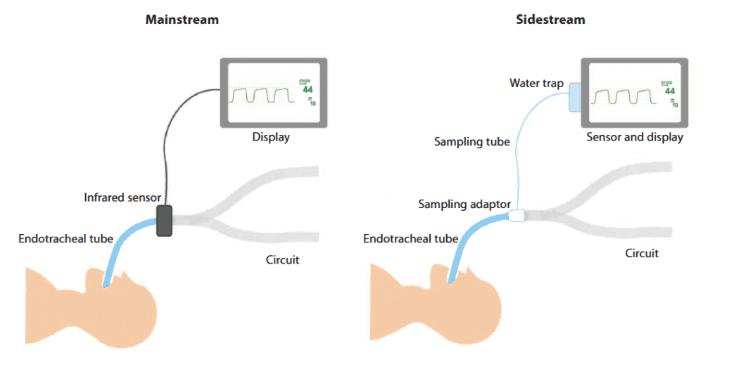 End-tidal CO2 monitoring