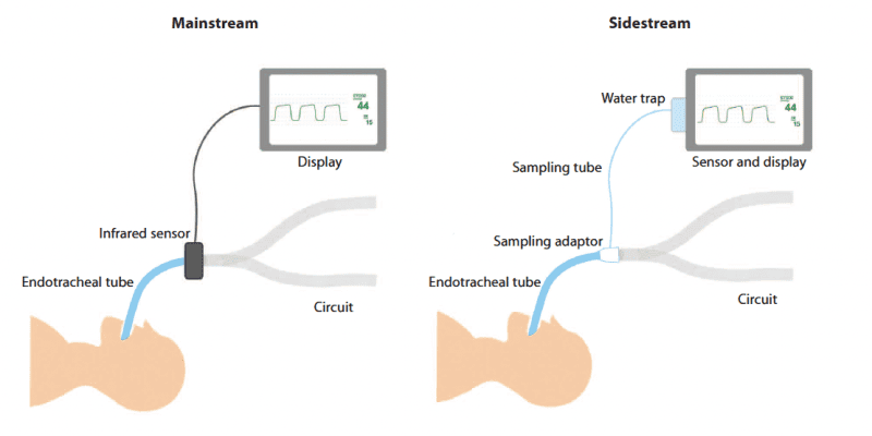 End-tidal CO2 monitoring