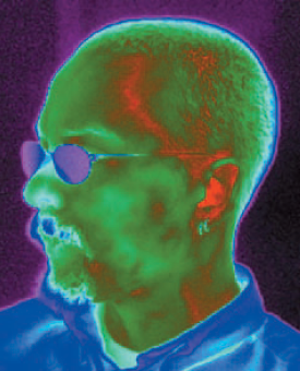 Physics, physiology and serendipity of temporal artery thermometry